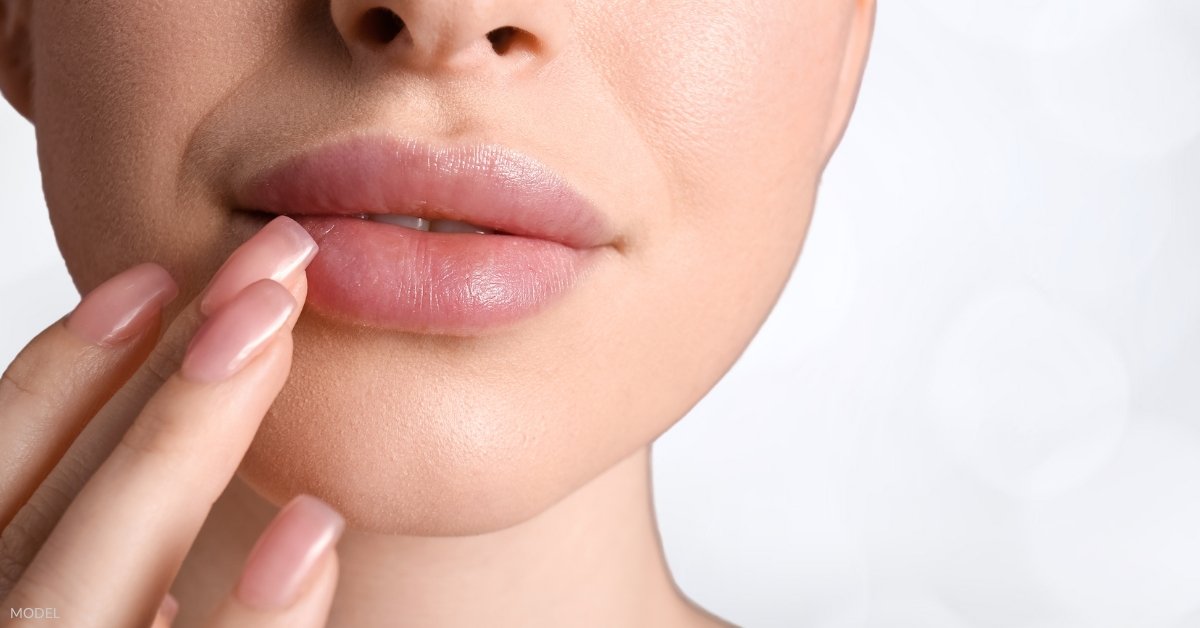 ‘Pillow Face’: The Perils of Too Much Filler – Dermatology Associates ...